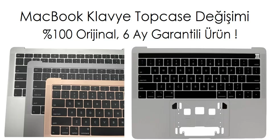 Macbook Klavye Topcase - MacAnakart